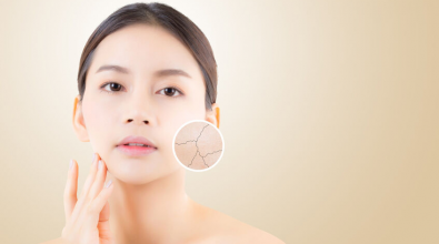 Peau sèche : 3 ingrédients essentiels contre la sécheresse cutanée ...